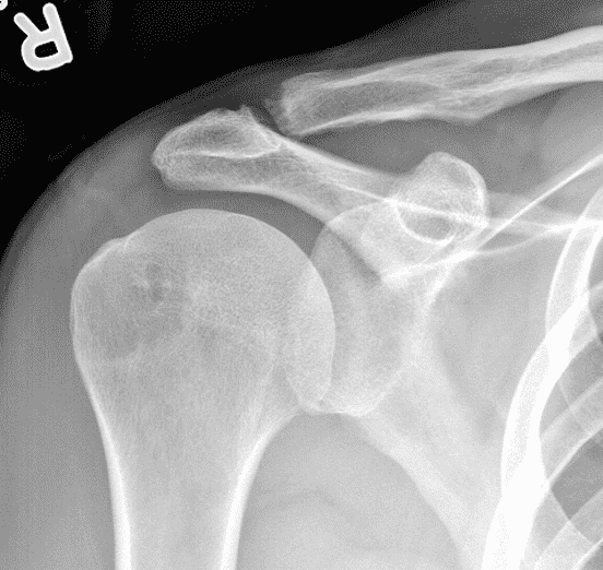 MRI Web Clinics | Radsource