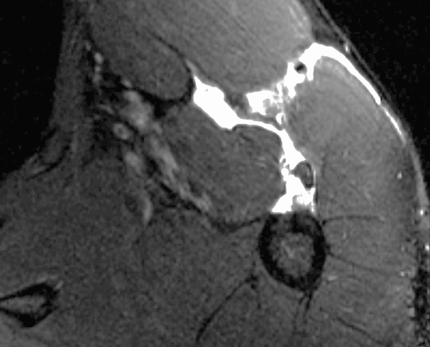 MRI Web Clinics | Radsource